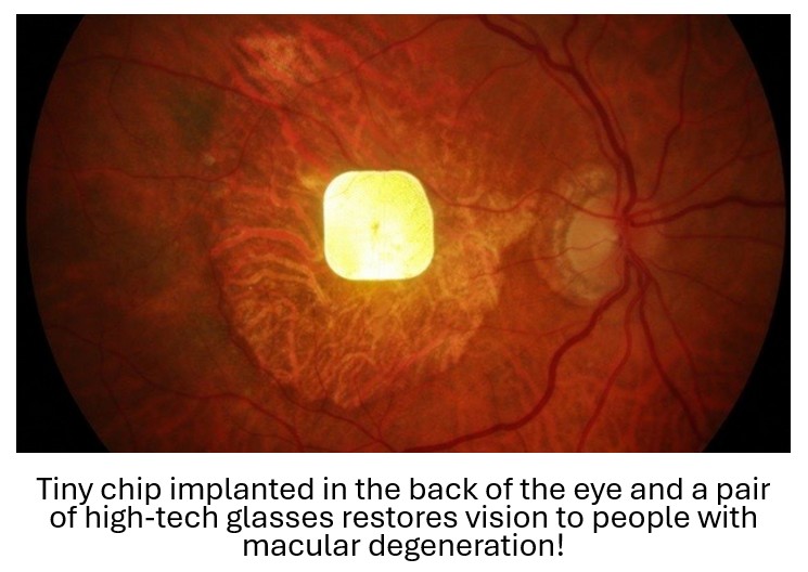 A Tiny Chip For The Eye – Into Tomorrow with Dave Graveline